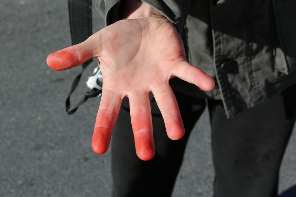 Work Injuries and Illnesses Related to Cold Weather - Auger & Auger